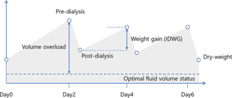 What Is Dry Weight For Dialysis